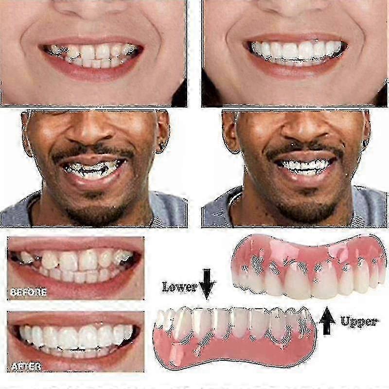 New Extra Thin Fake Bright White Tooth Veneers Silicone Soft Safe ...