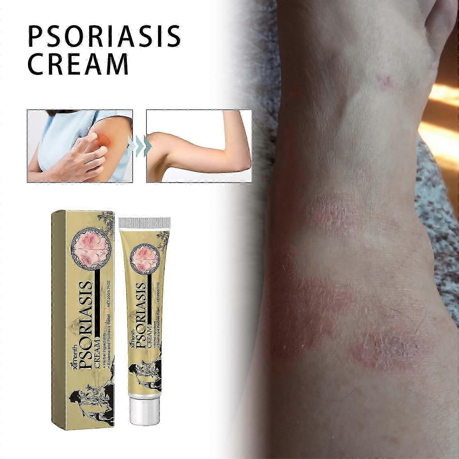 Ximonth Skin Anti-Itch Ointment Relieve Redness And Itching Of Hands ...