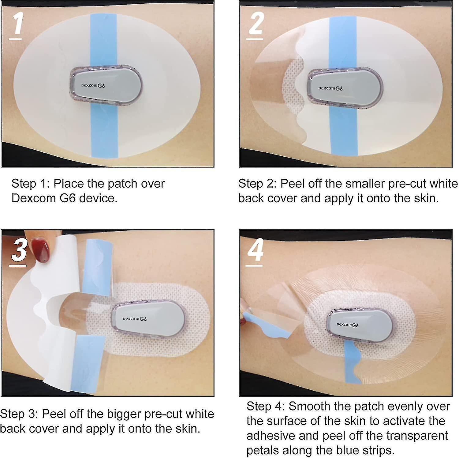 For Dexcom G6 Adhesive Patches, Waterproof Patches For Dexcom G6, Premium Transparent Overpatch ...