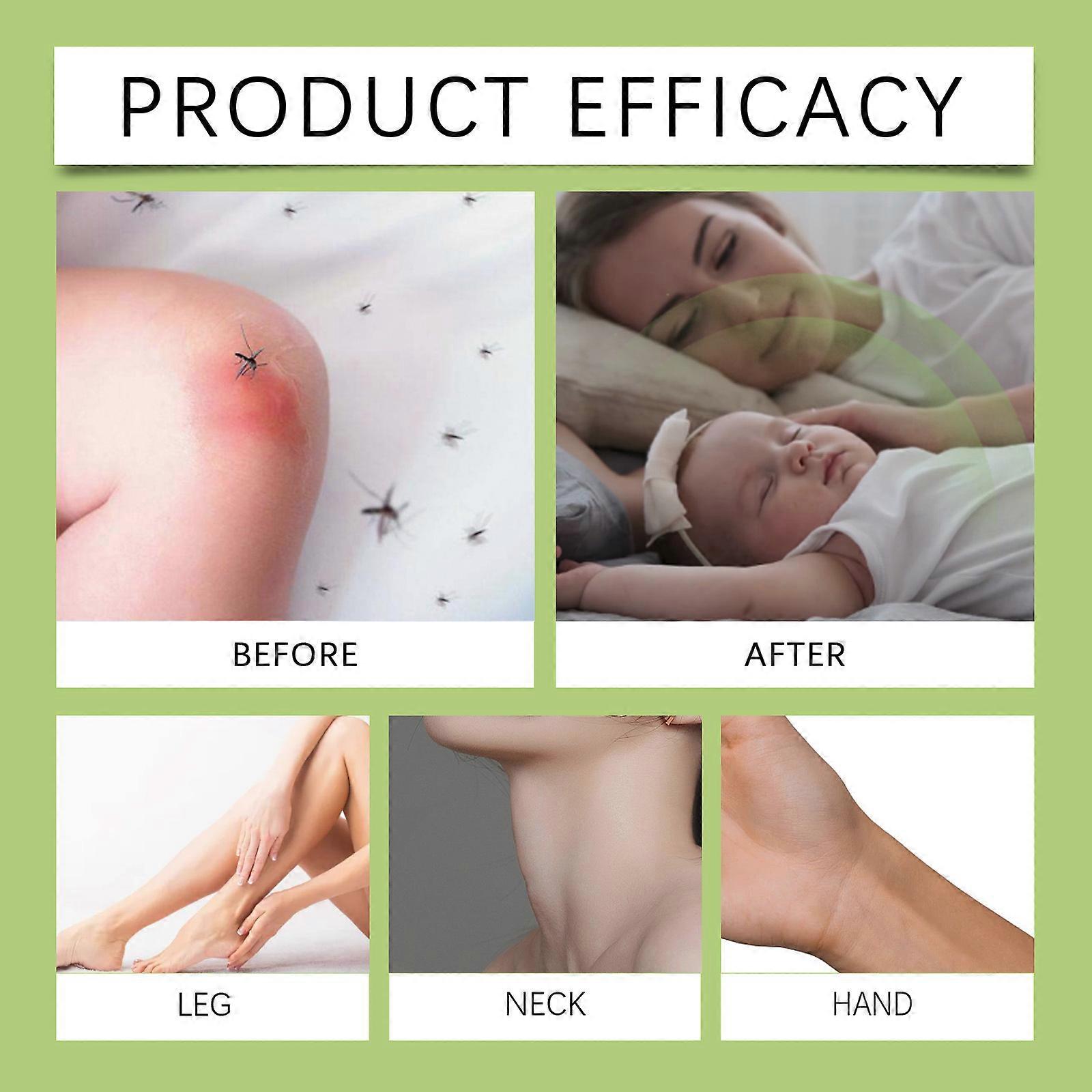 Bite repellent spray, home camping outdoor sports portable mosquito ...