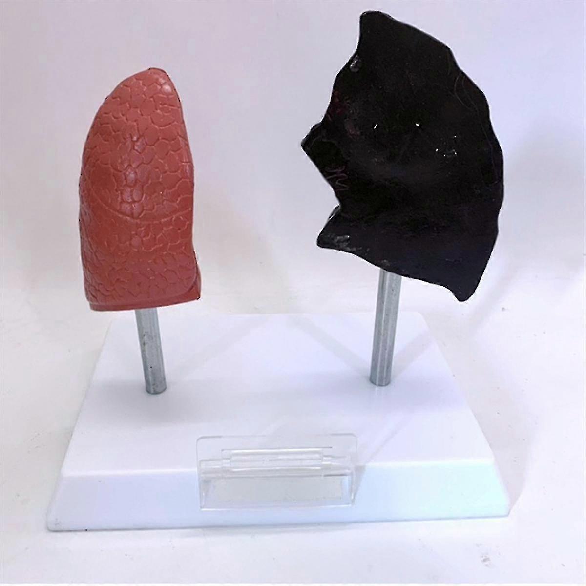 Smoker'S Lung Model Healthy Lung Model Lung Anatomy Model with ...