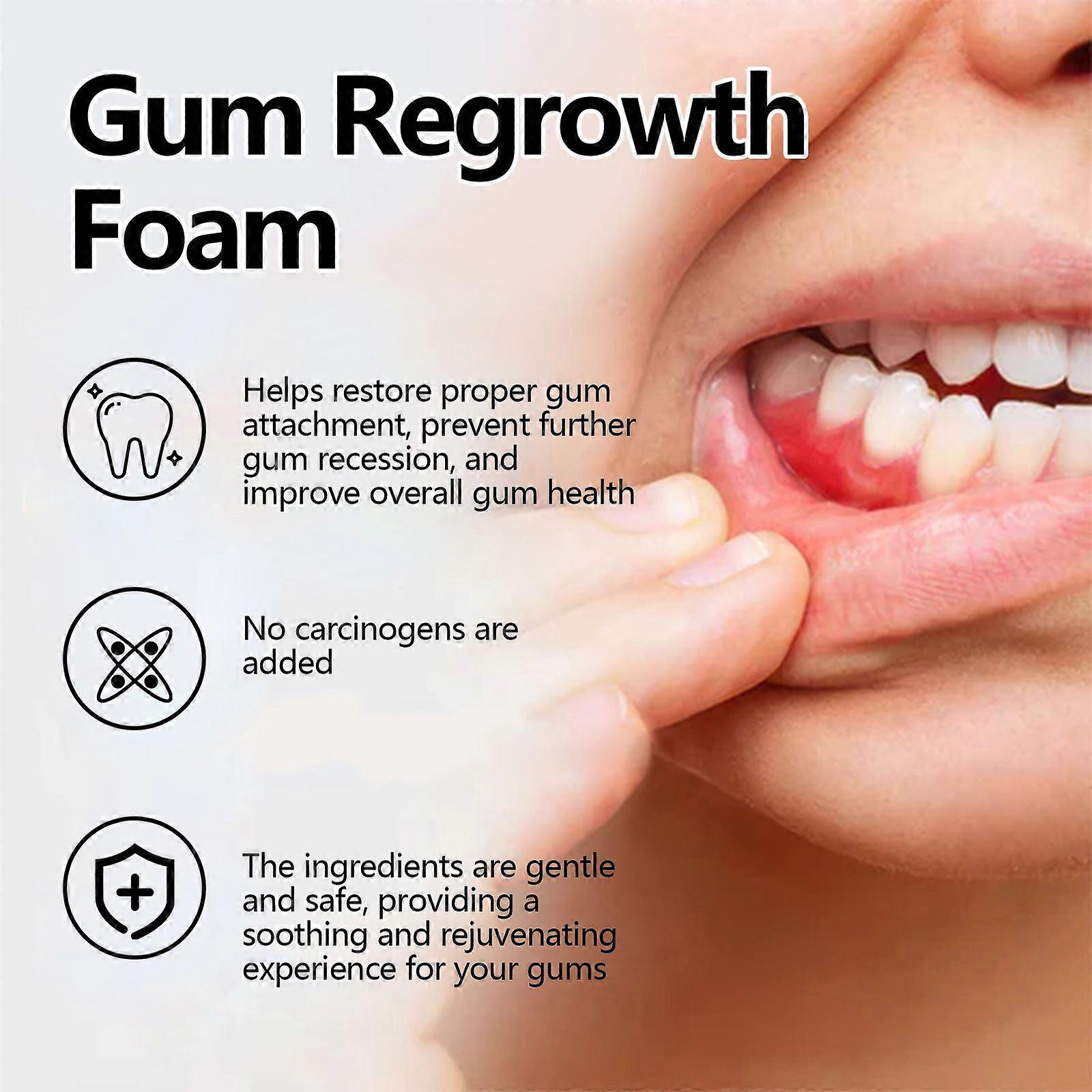 Gum Regrowth Foam, Gum Treatment Foam, Anti-Inflammatory, Gum Tissue ...