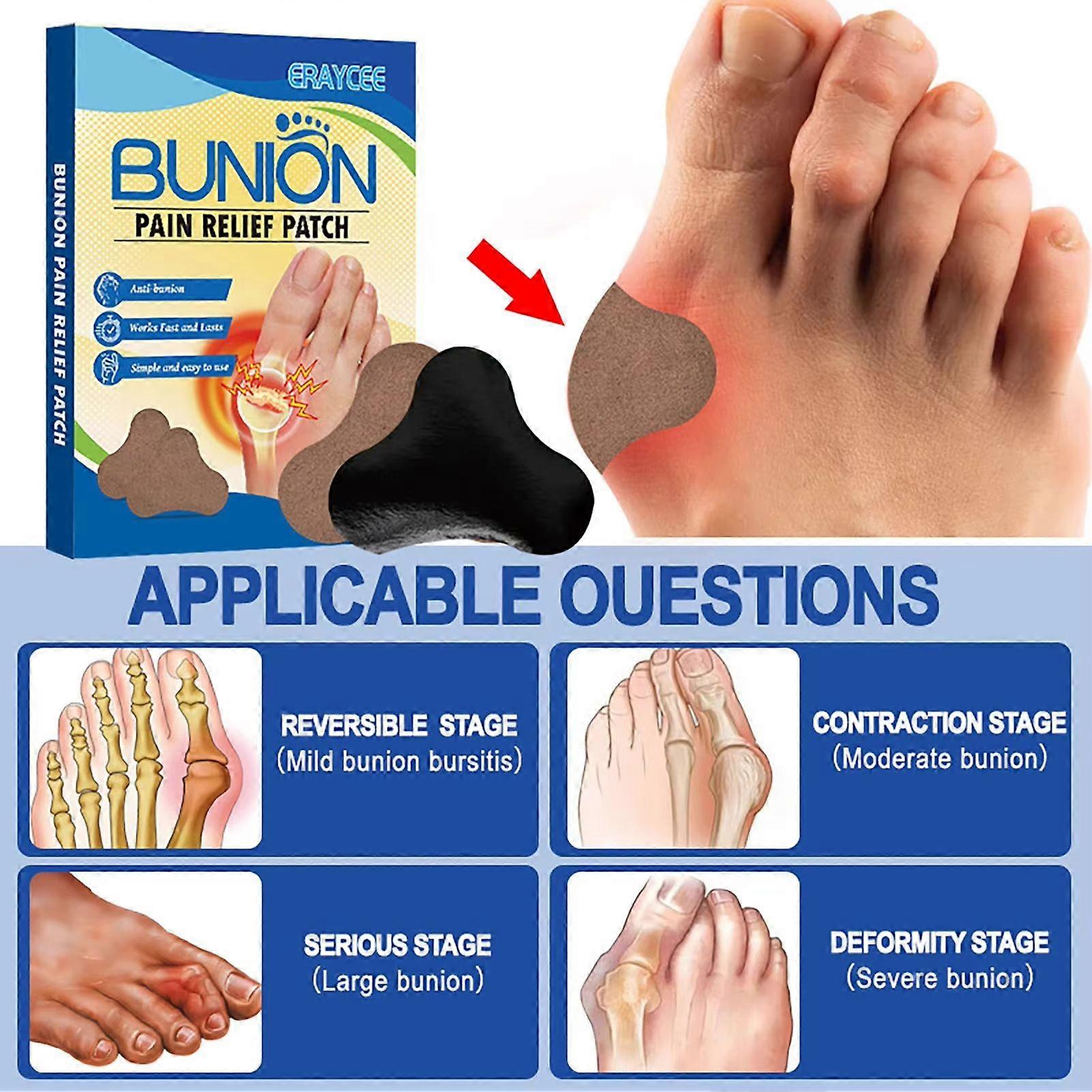 Anti Bunion Patches Bunion Corrector Toe Separator Orthopedic ...