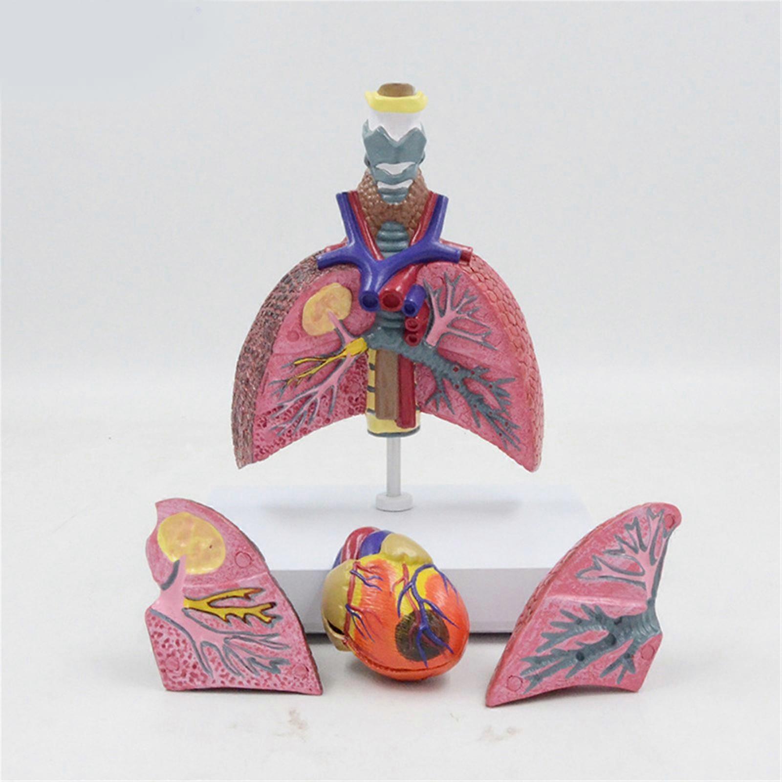 Anatomical Respiratory System Model Life Size Pathological Lung Anatomy ...