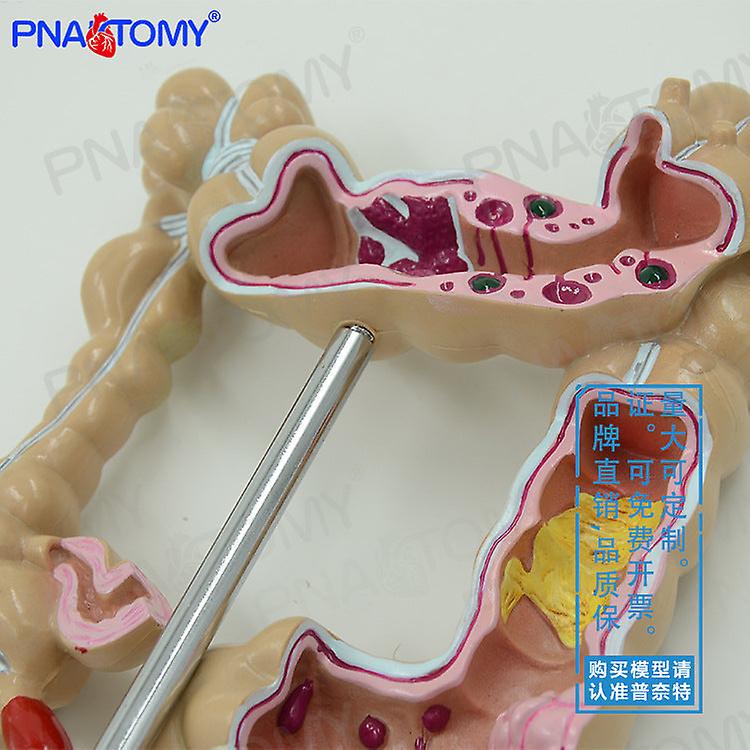 Human Model Simulation Human Colon Anatomy Model Anorectal Intestinal ...