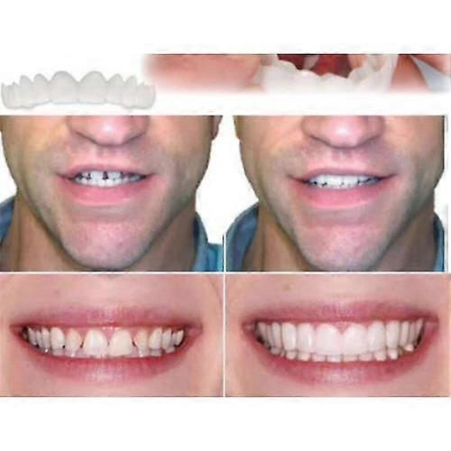 Perfect Smile Veneers Comfort Fit - Flex Denture Paste Braces | Fruugo UK