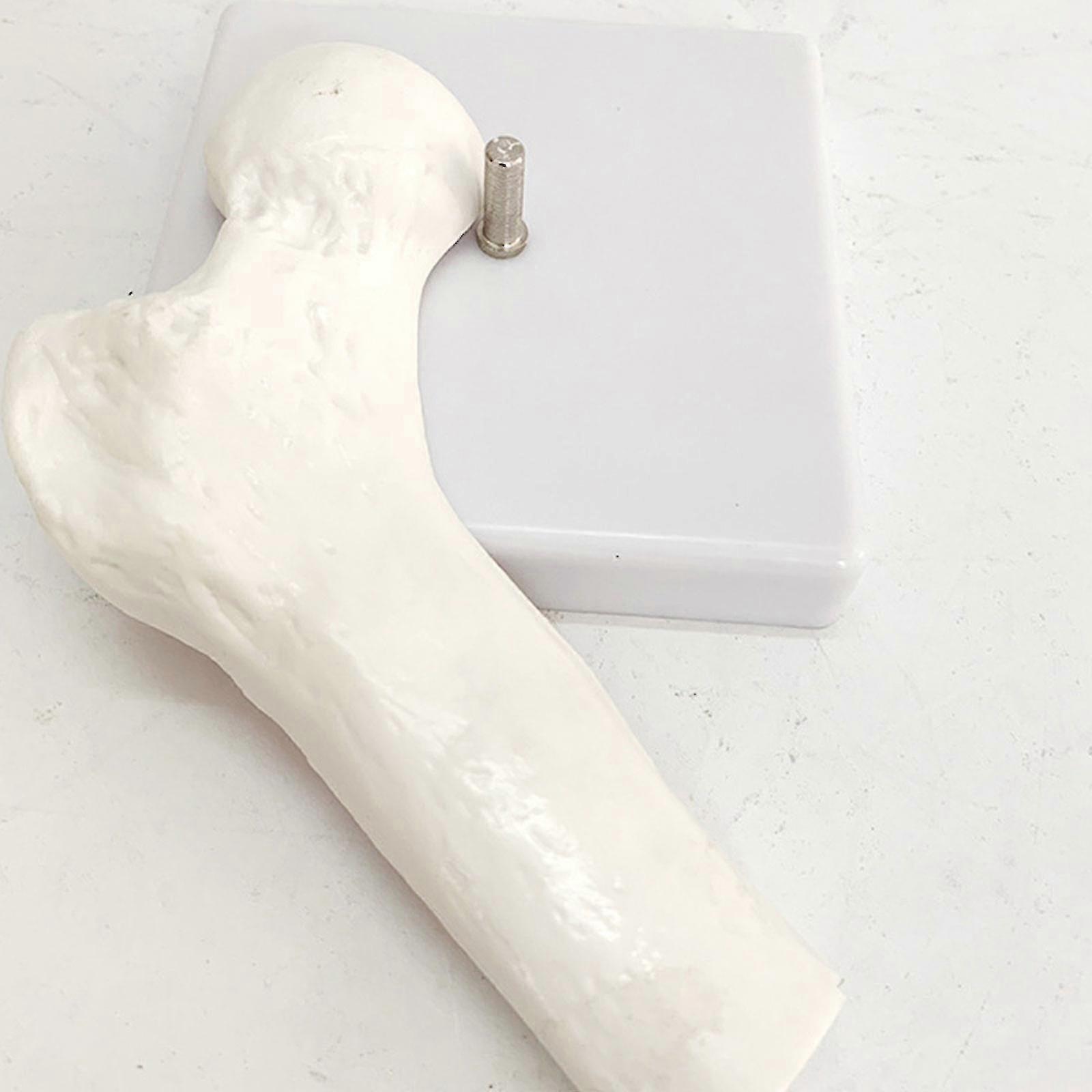 Femur Leg Bone Disease Model Pvc Anatomical Model For Anatomy Teaching ...