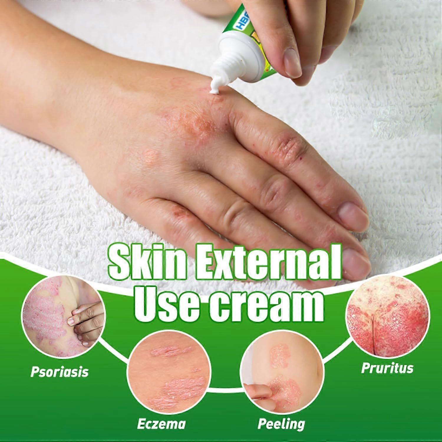 Antifungal Cream 20g - Anti Fungal Skin Cream Relief Jock Itch, Ringworm, Eczema, Antifungal ...