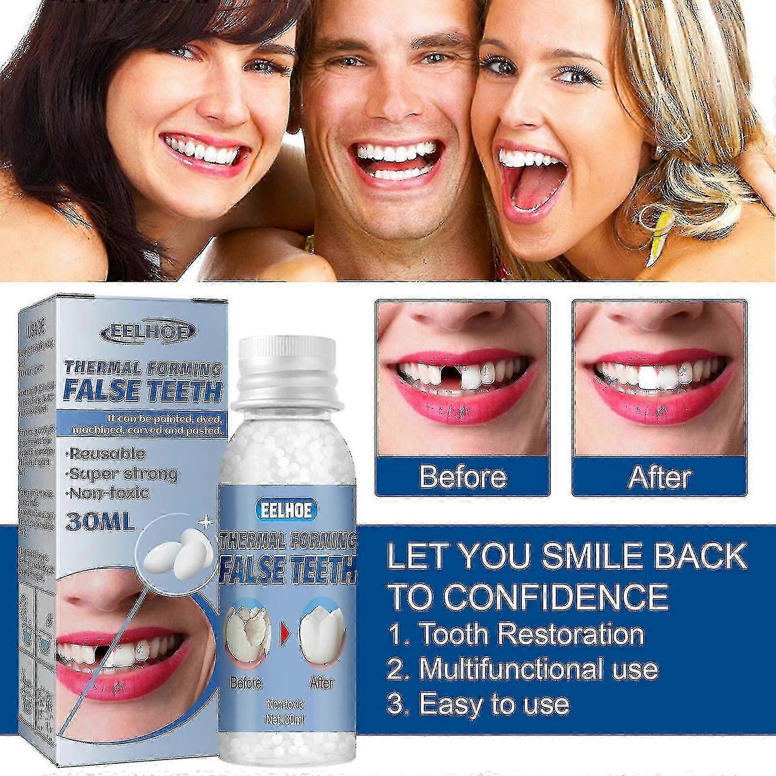 Thermal Forming False Teeth Tooth Repair Kit Tooth Repair Granules For ...