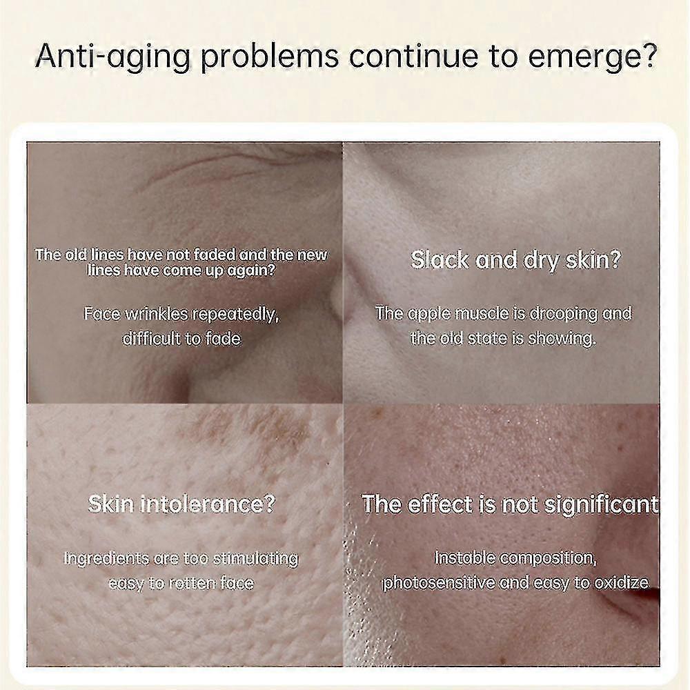 Japanese Qingling Wrinkle Removal Cream,qingling Firming Anti-aging ...