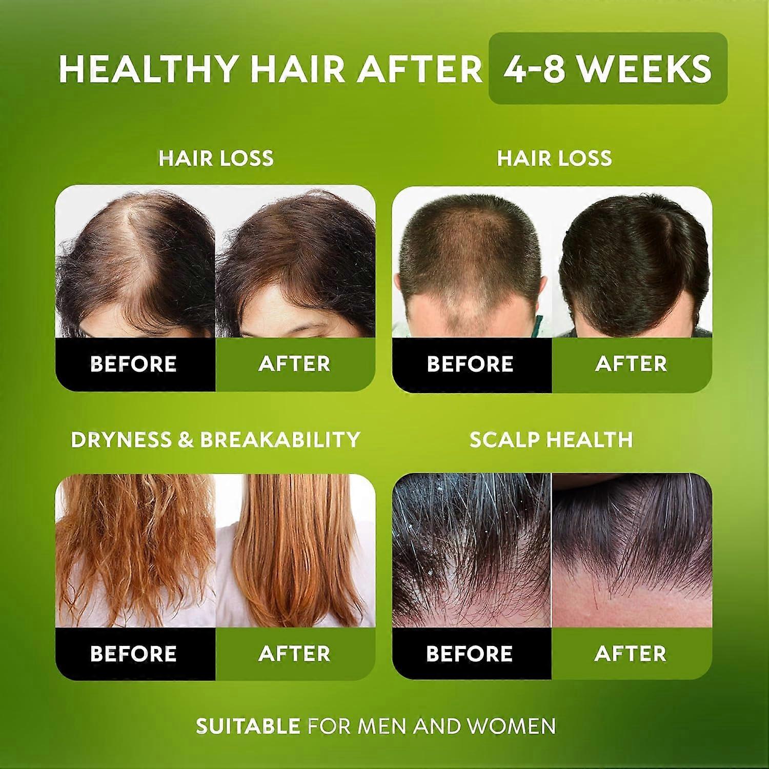 Batana Oil for Hair Growth - 100% Raw & Organic Batana Oil - Cold ...