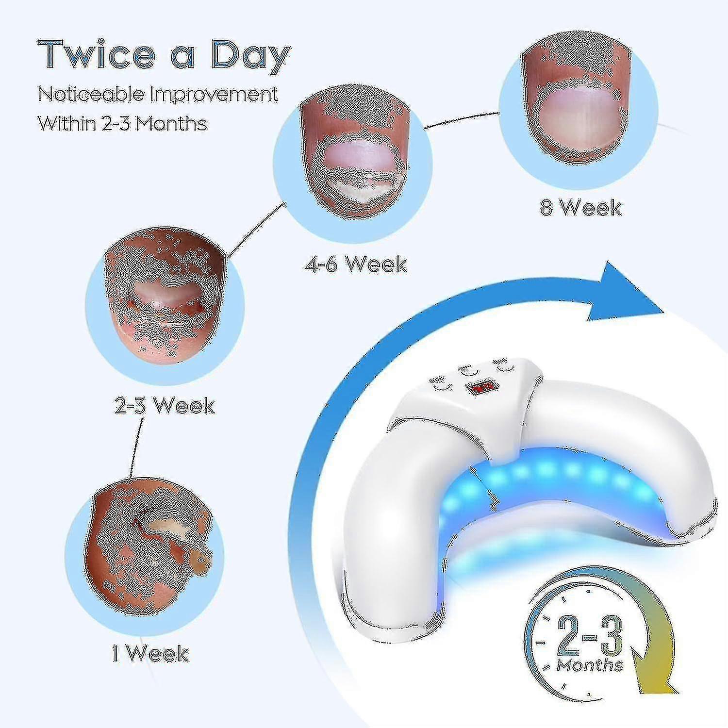 2024 (best)Nail Fungus Laser Treatment Device For Multiple Toenail, Home Use 905nm Infrared ...