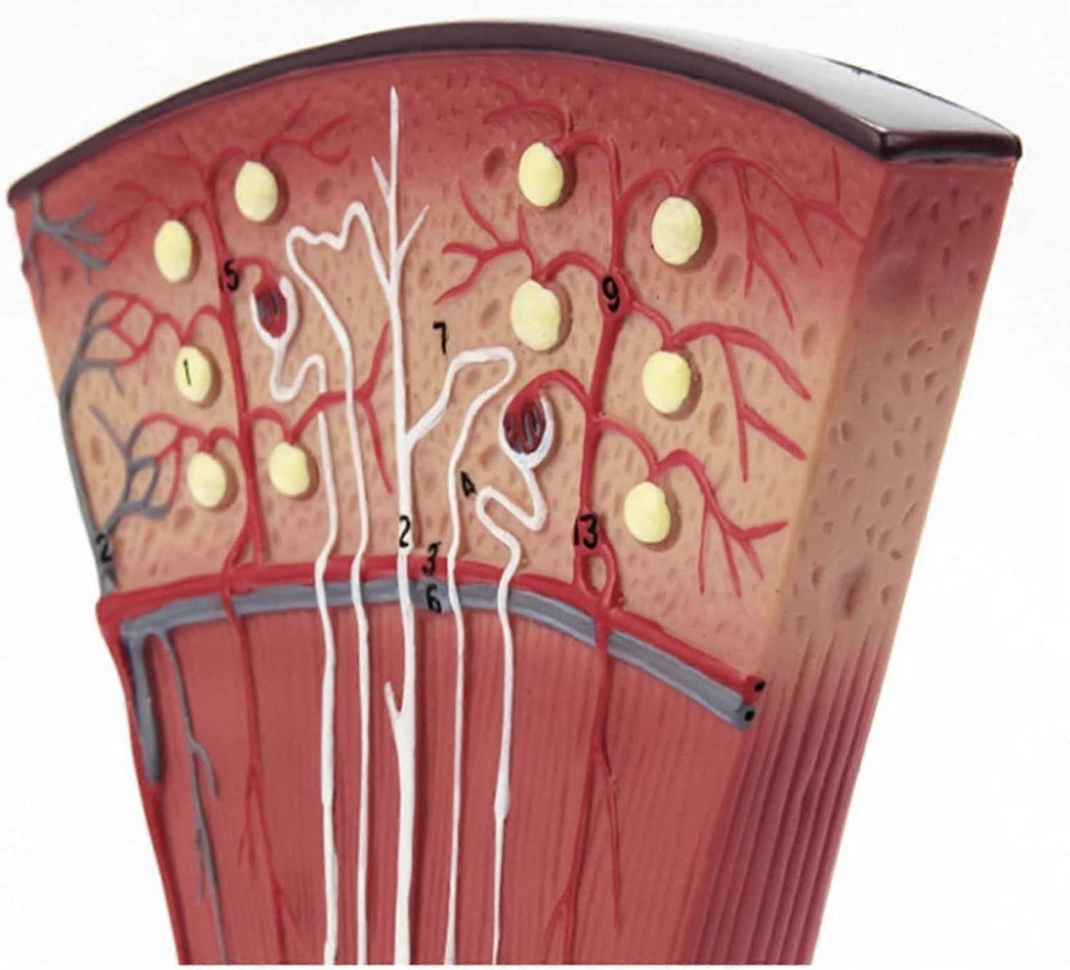 Human Diseased Kidney Teaching Model for Study, Human Organ Kidney Cyst ...