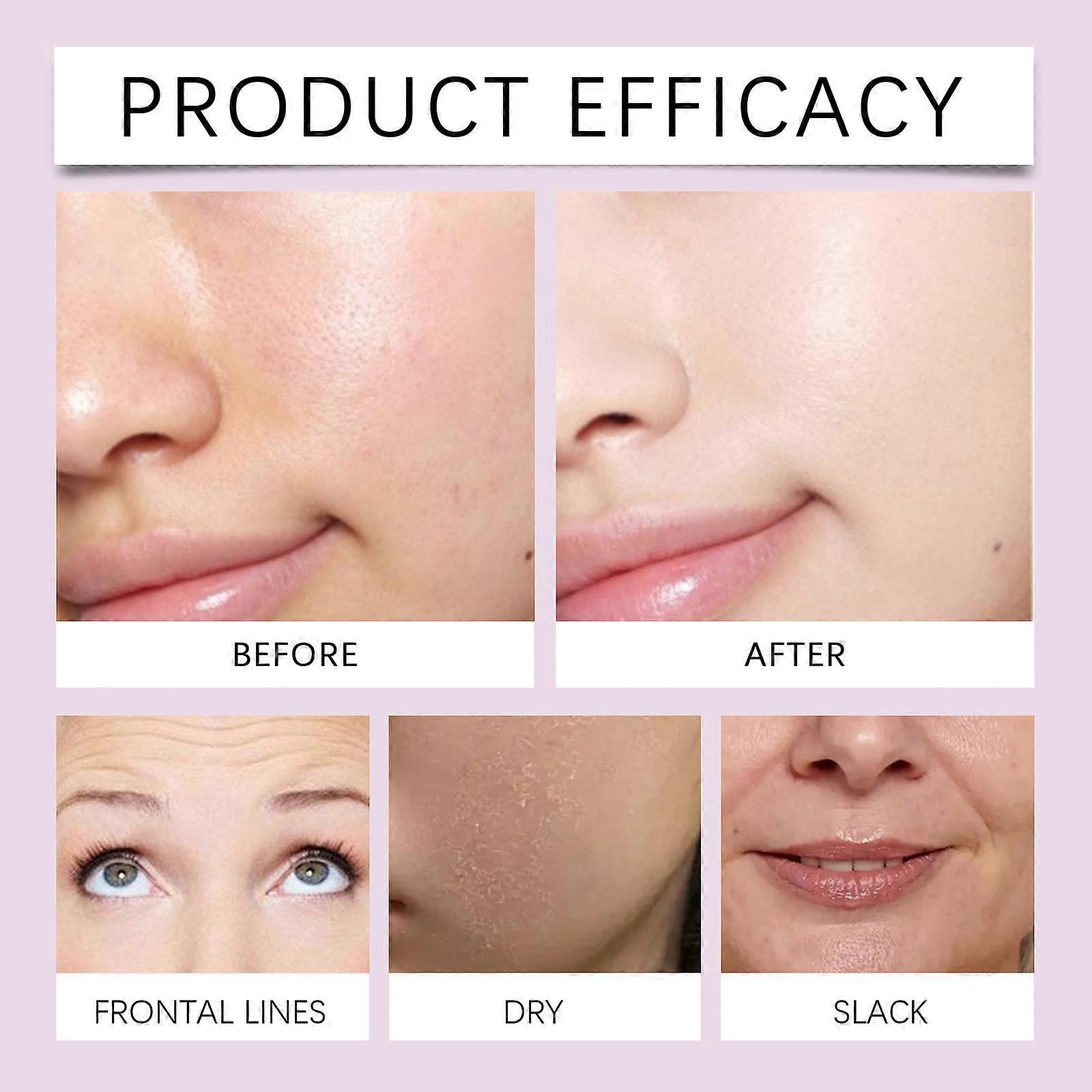 Forehead Wrinkle Patches for Anti-Wrinkles: Overnight Face Wrinkles ...