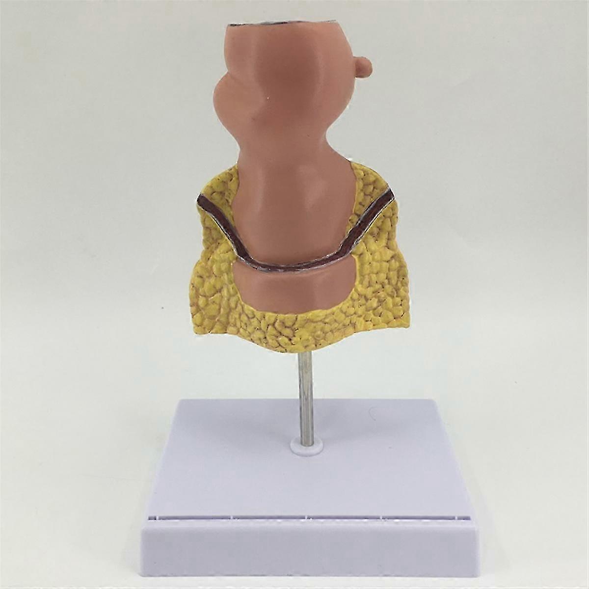 Human Rectum Model With Common Pathologies,replica For Anatomy And Physiology Education,doctor's ...