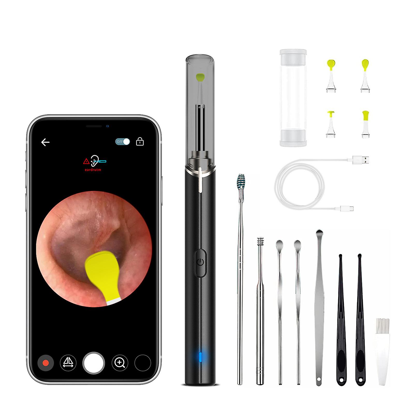 Intelligent Visual Ear Otoscope Leds Portable Picker Ear Camera ...