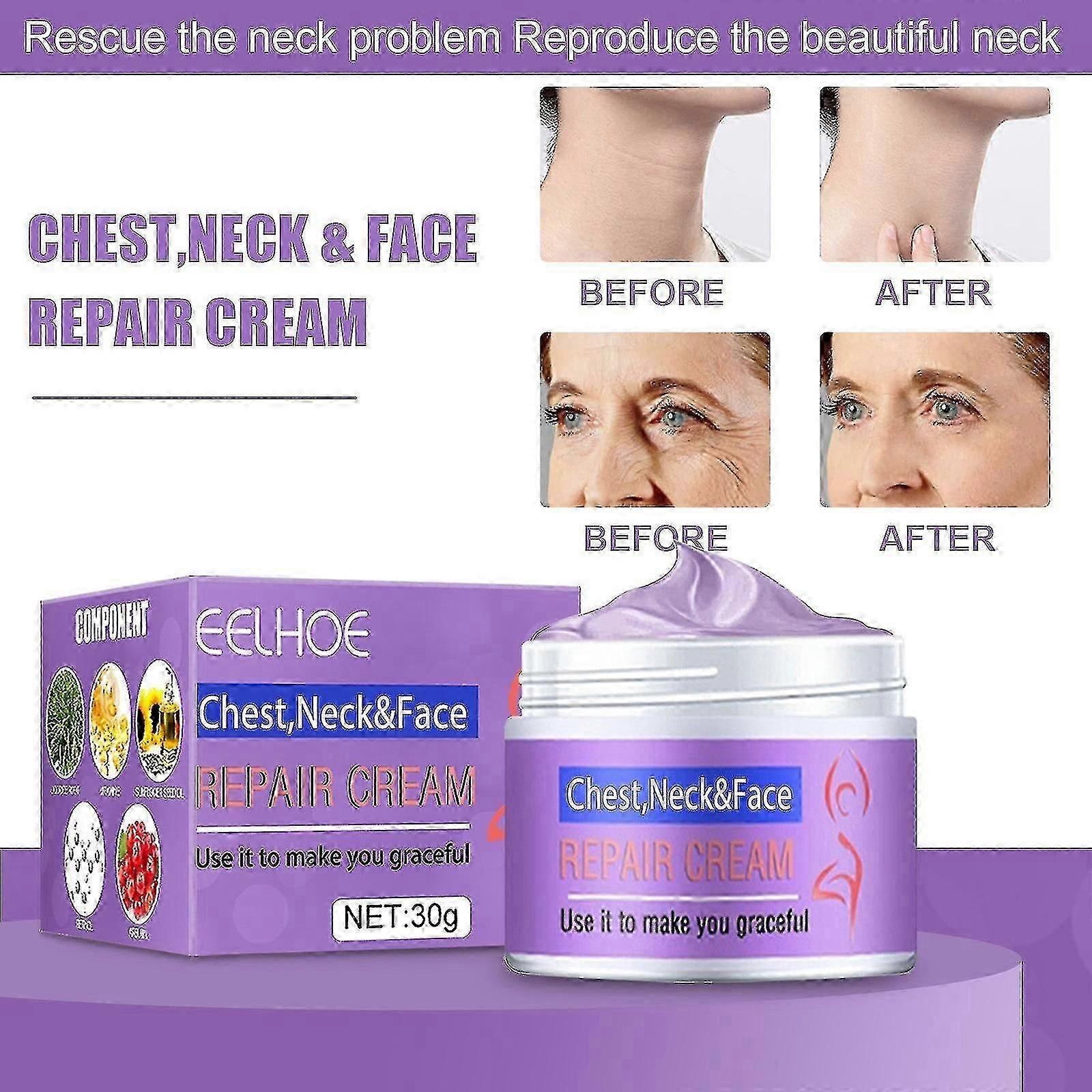 Neck Firming Cream, Anti-aging Moisturizer For Neck And Shoulders, Double Chin Reduction, Skin ...