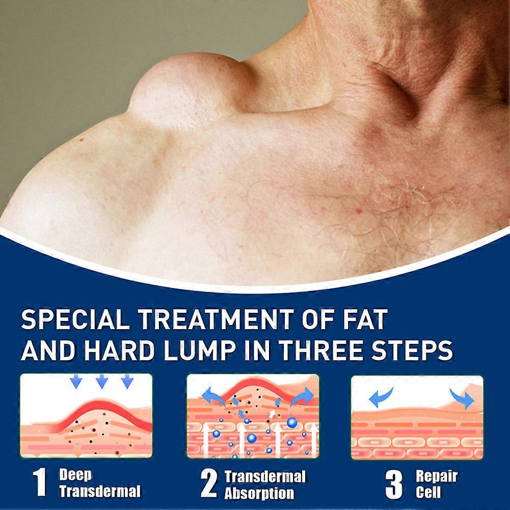 Lipomas Removal Cream Painless Lipolysis Cellulite Fat Lumps Dissolving ...