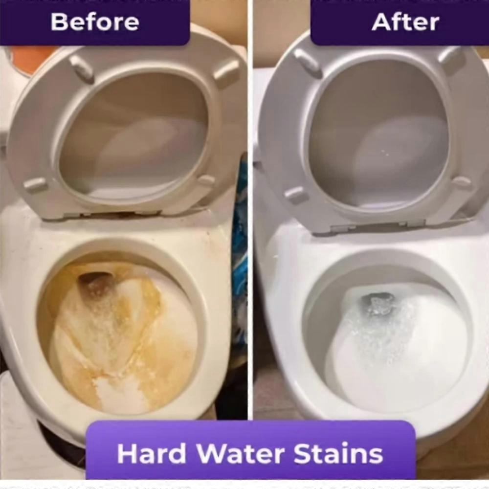 3X Fizzclean Toilet Foam Cleaner, Insta-Action Fizzclean Foam Cleaner ...