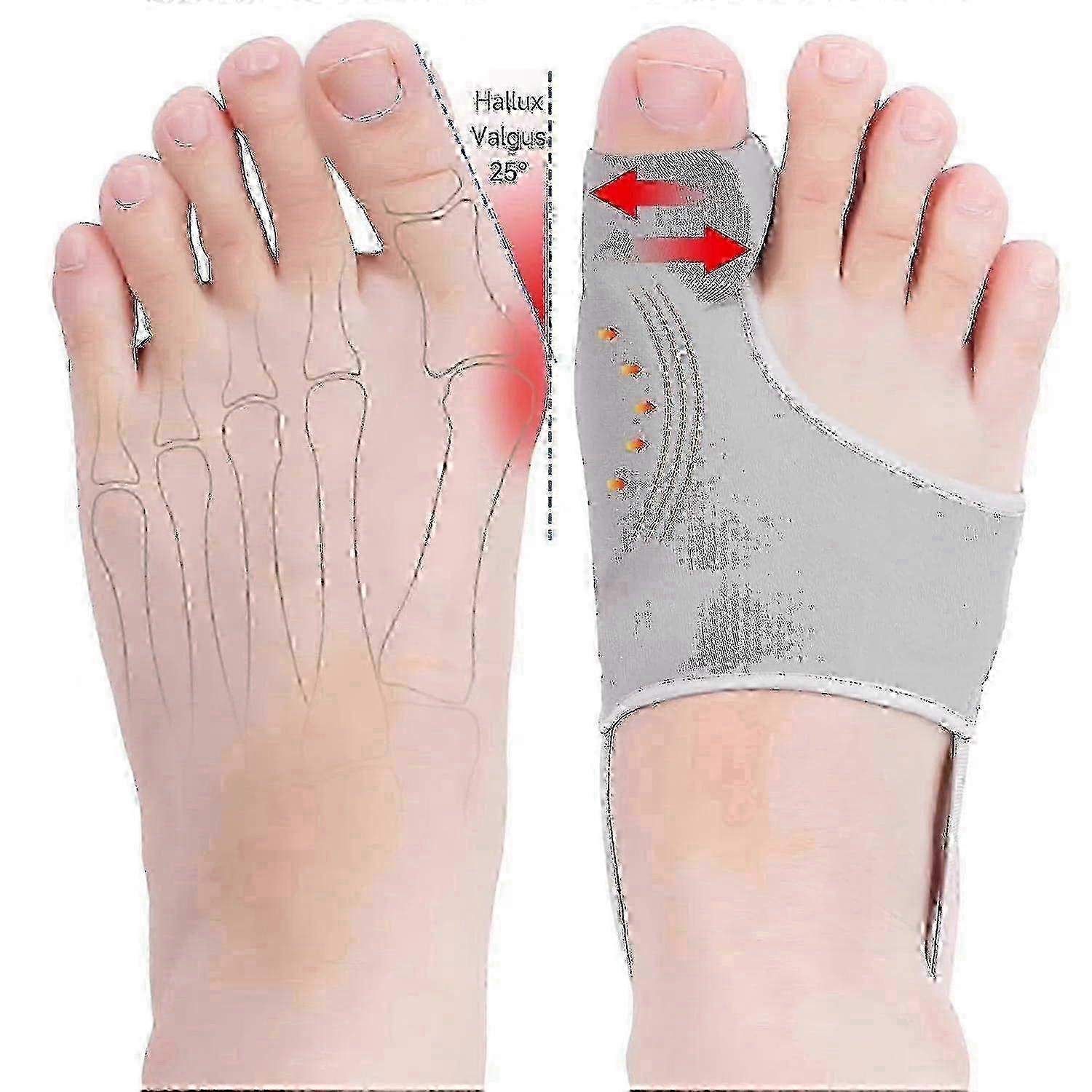 Hyggear Adjustable Bunion Corrector with Silicone Pads - Toe Separator ...