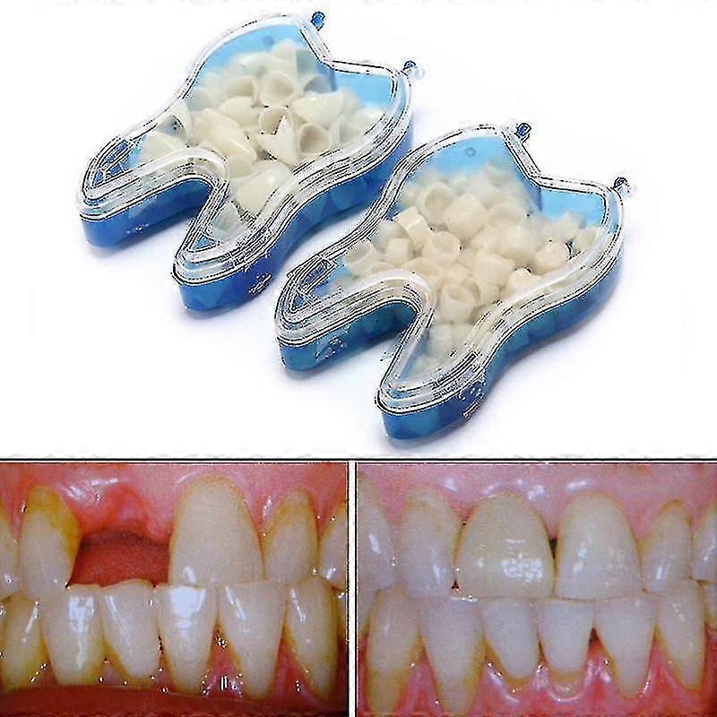 Temporary Tooth Kit, Replace A Missing Tooth In Minutes new | Fruugo UK