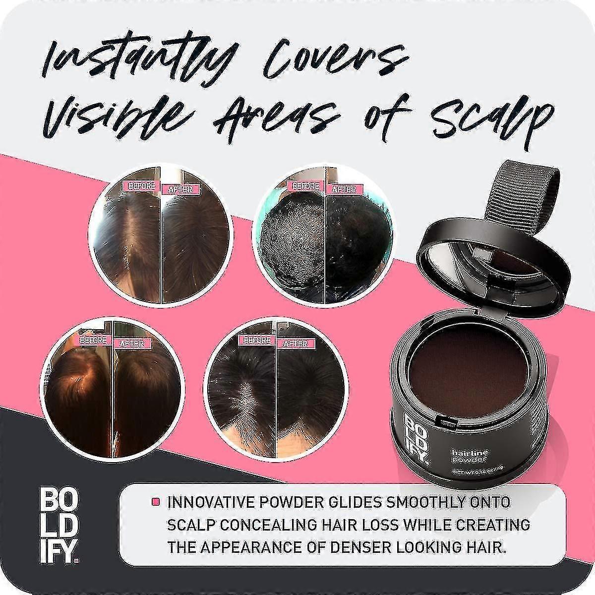 Hairline Powder (auburn) Instantly Conceals Hair Loss And Fills In ...