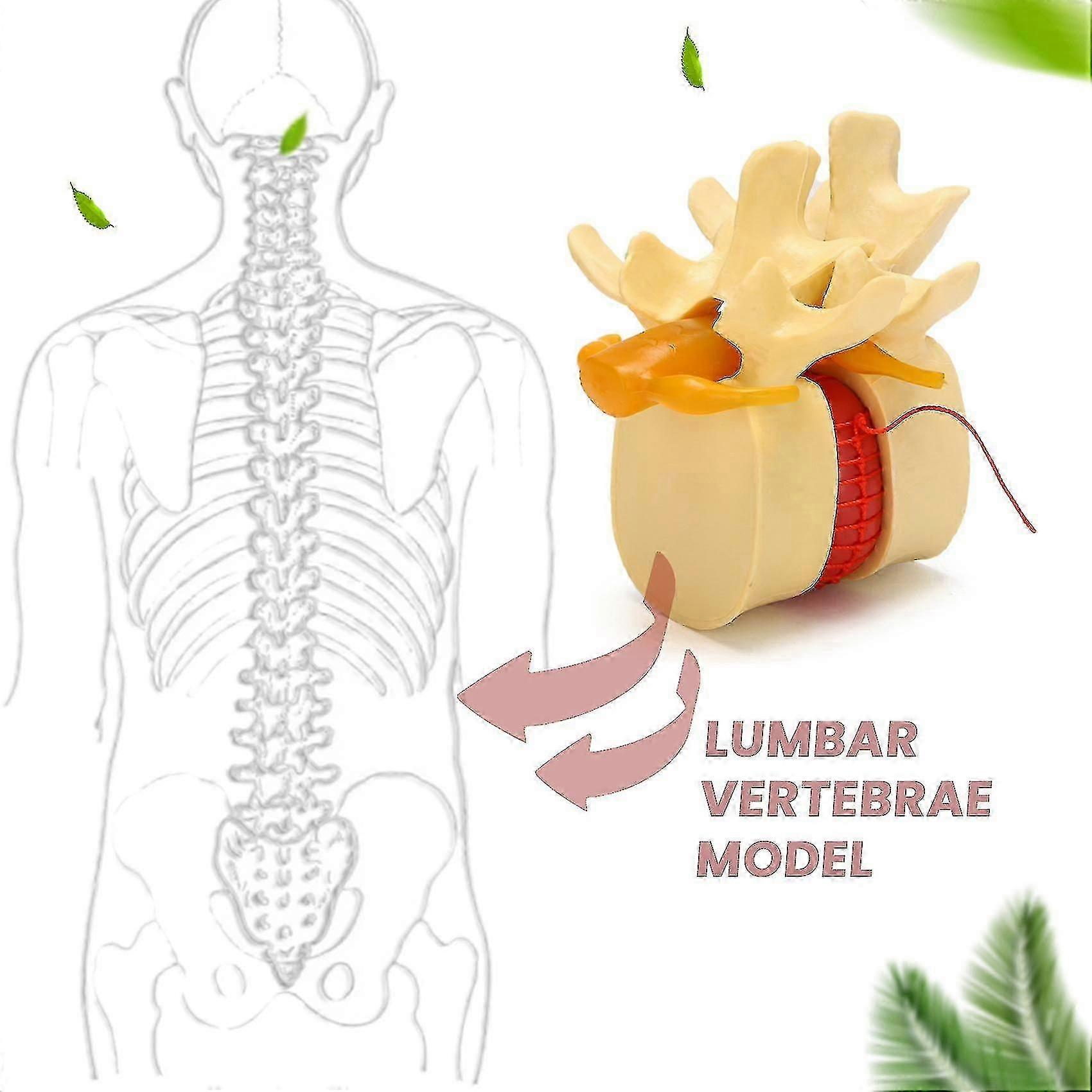 Lumbar Vertebrae Model Anatomical Spine Lumbar Disc Herniation Anatomy ...