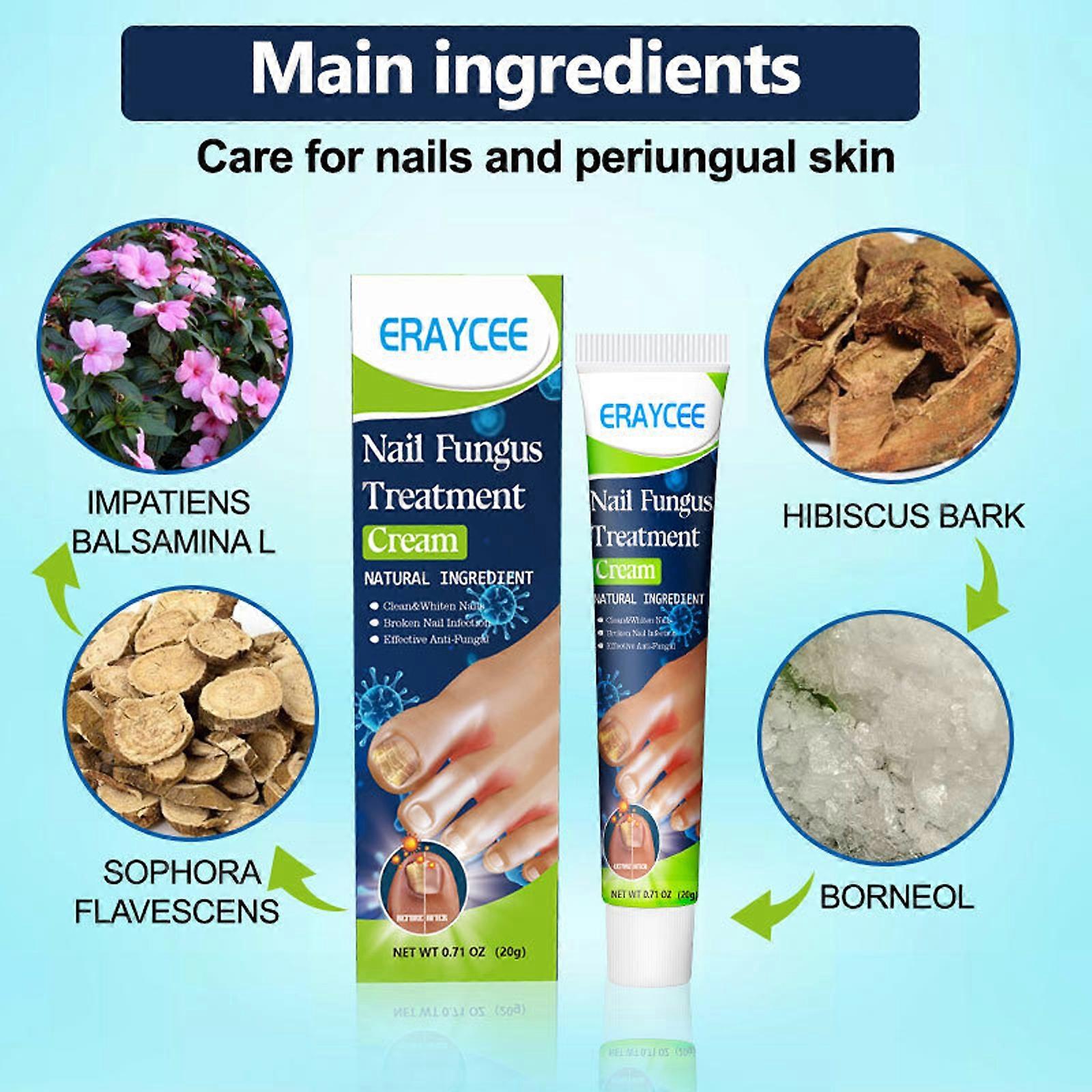 Nail Fungus Treatment Cream - Fungus Nail Cream, Toe Nail Repair ...