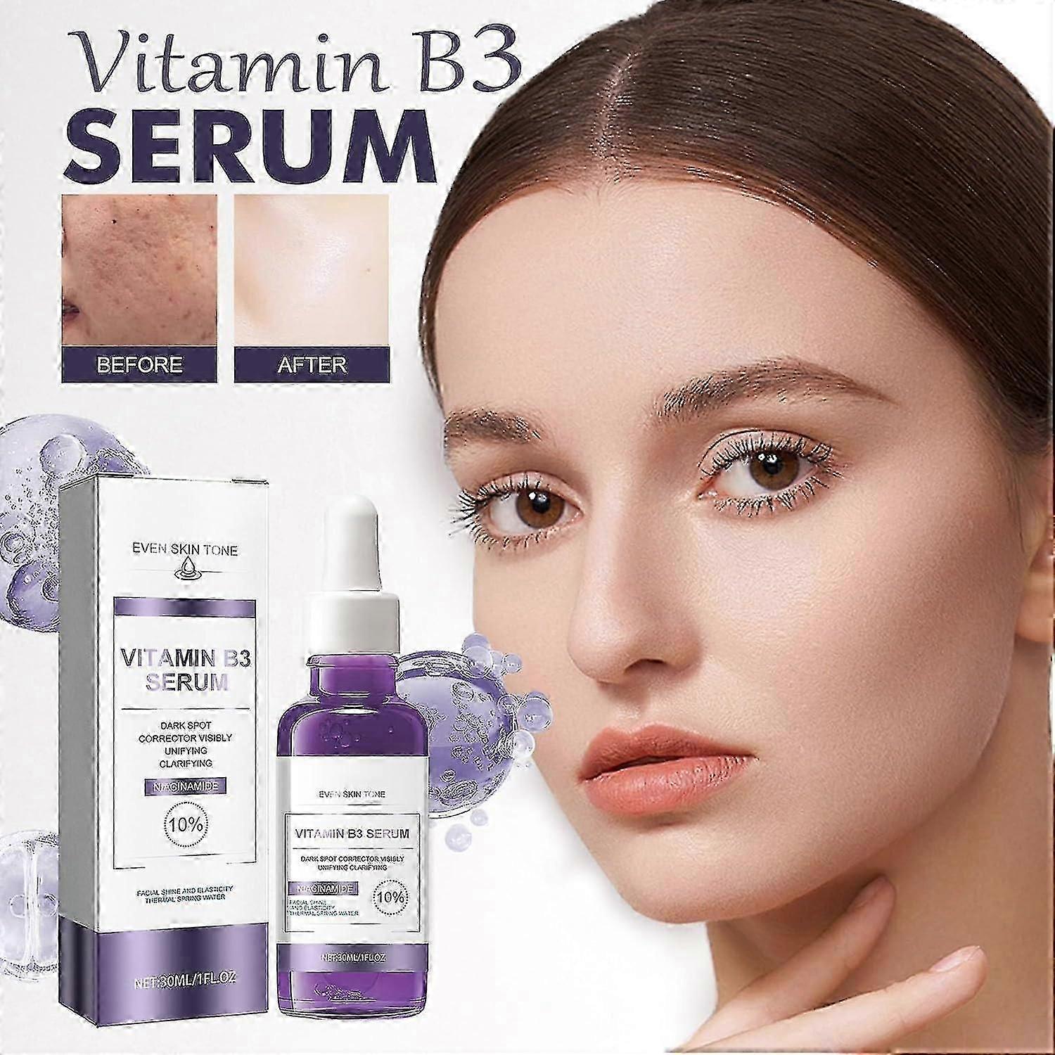 Vitamin B3 Serum,Dark Spot Corrector With Anti-Aging Face Serum+10% ...