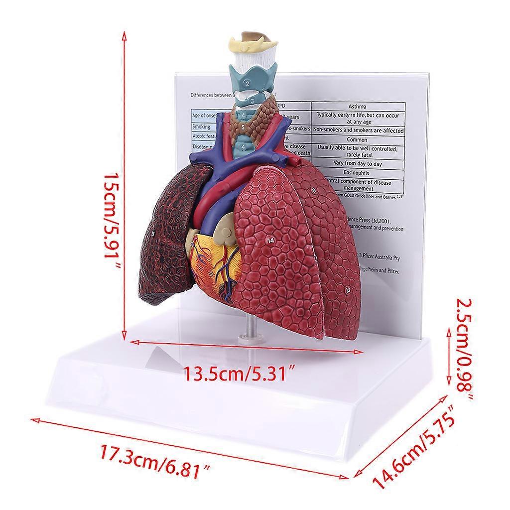 Life Size Human Lung Model Anatomical Respiratory System Anatomy ...