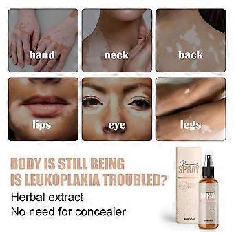 Repigment Vitiligo Removal Spray White Spot Relief Treatment ...