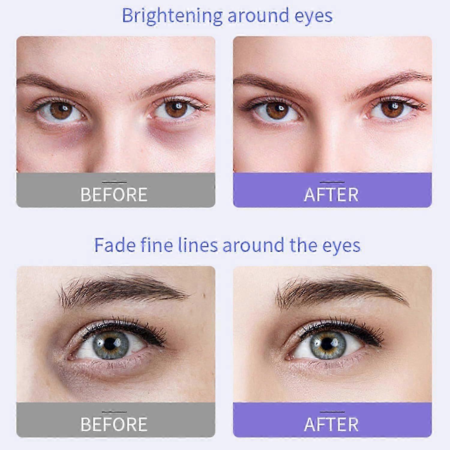 Anti-Aging Firming Eye Cream, Eye Cream for Dark Circles and Puffy Eyes ...