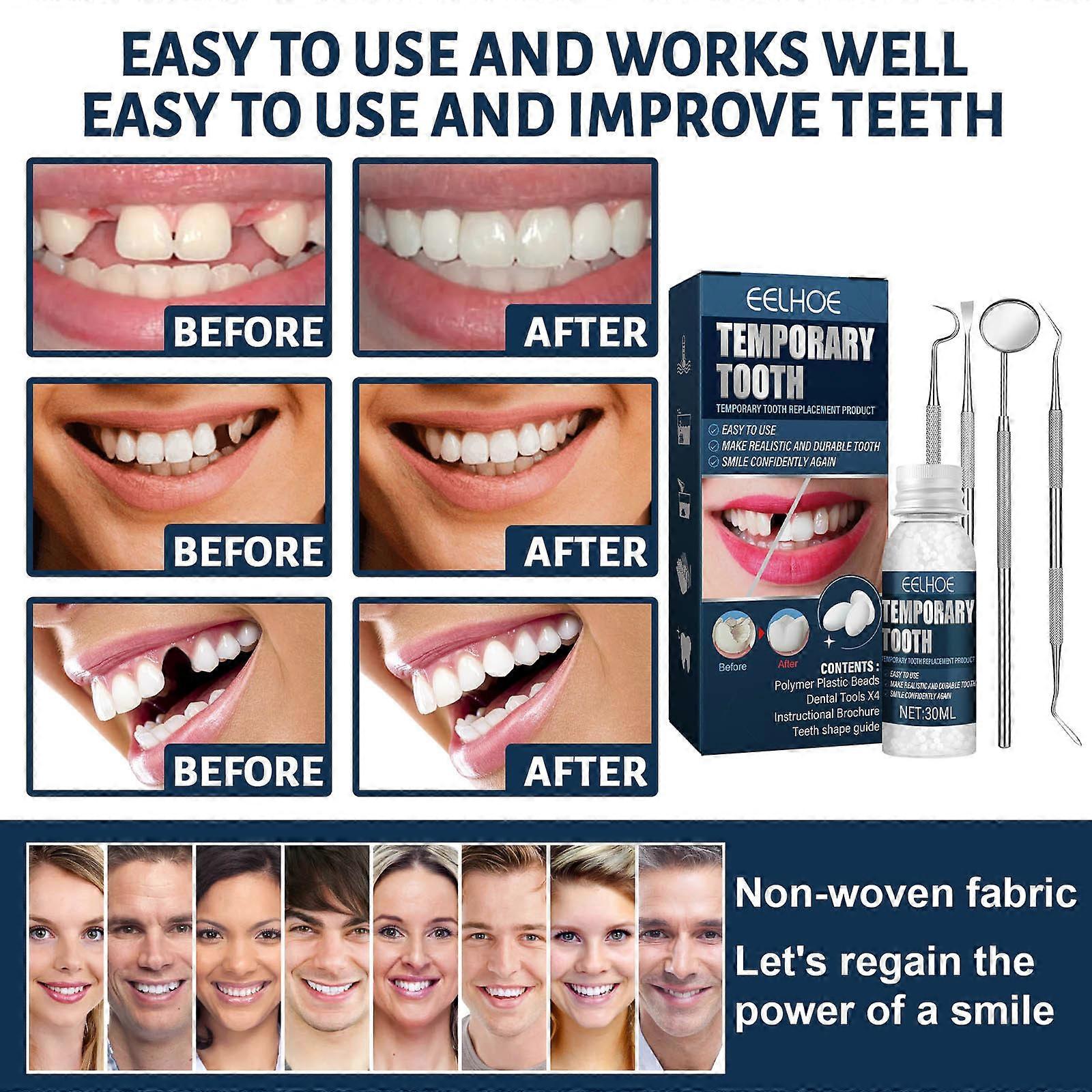 Moldable Tooth Filling False Teeth Temporary Repair Kit Solid Glue ...