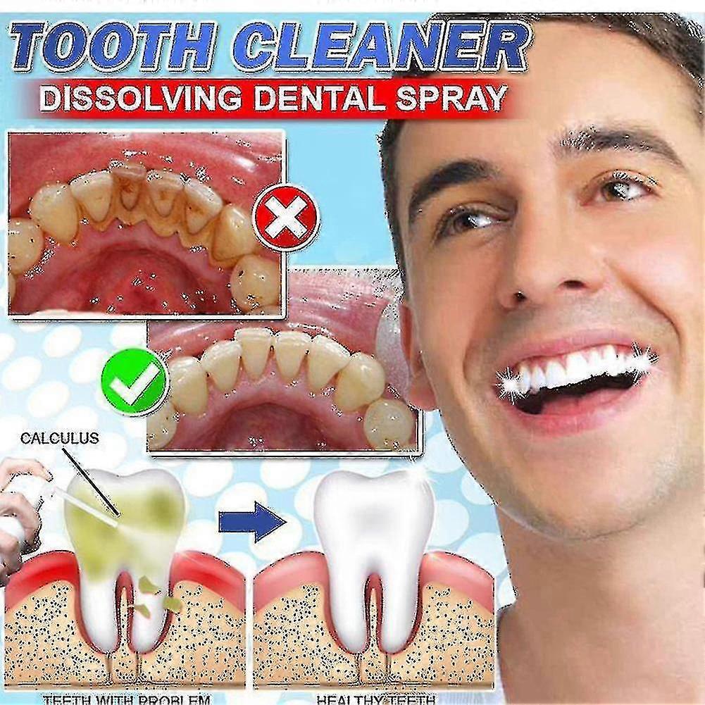 10/30ml Dental Calculus Cleaning Halitosis Stone Remove Teeth Whitening ...