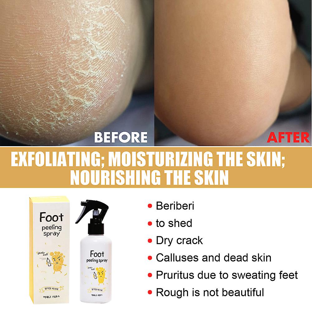 Foot Exfoliation Repair & Brightening Spray Remove Dead Skin Calluses ...