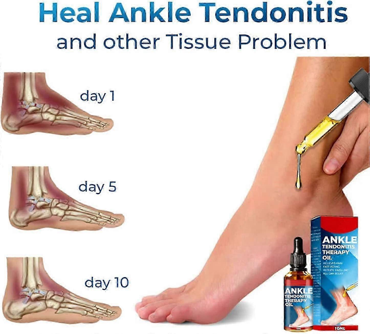 Ankle Tendonitis Therapy Oil, German Ankle Tendonitis Therapy Oil, Foot ...