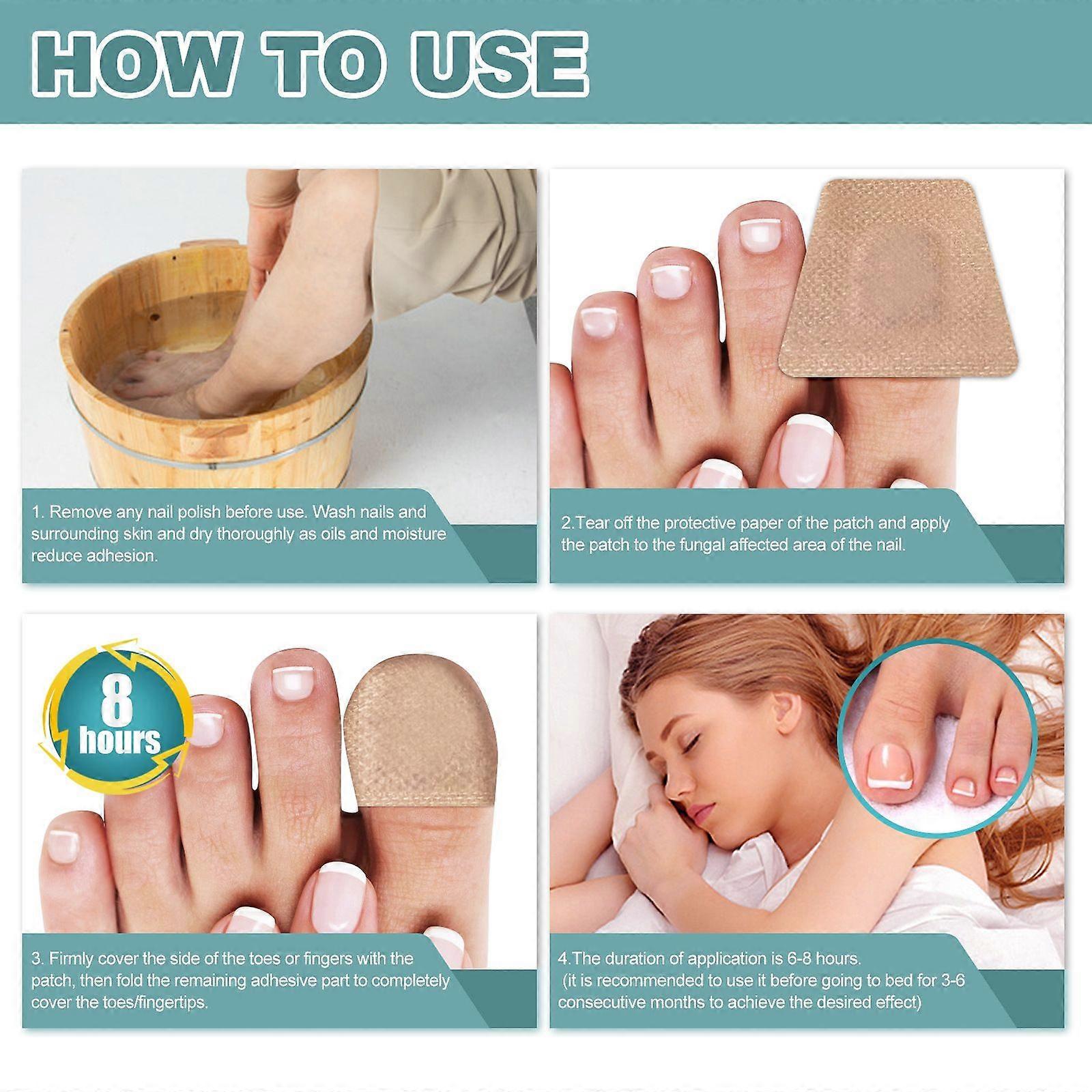 Nail Repair Patch, Hand And Foot Nail Care Soft Nail Inlay Nail ...