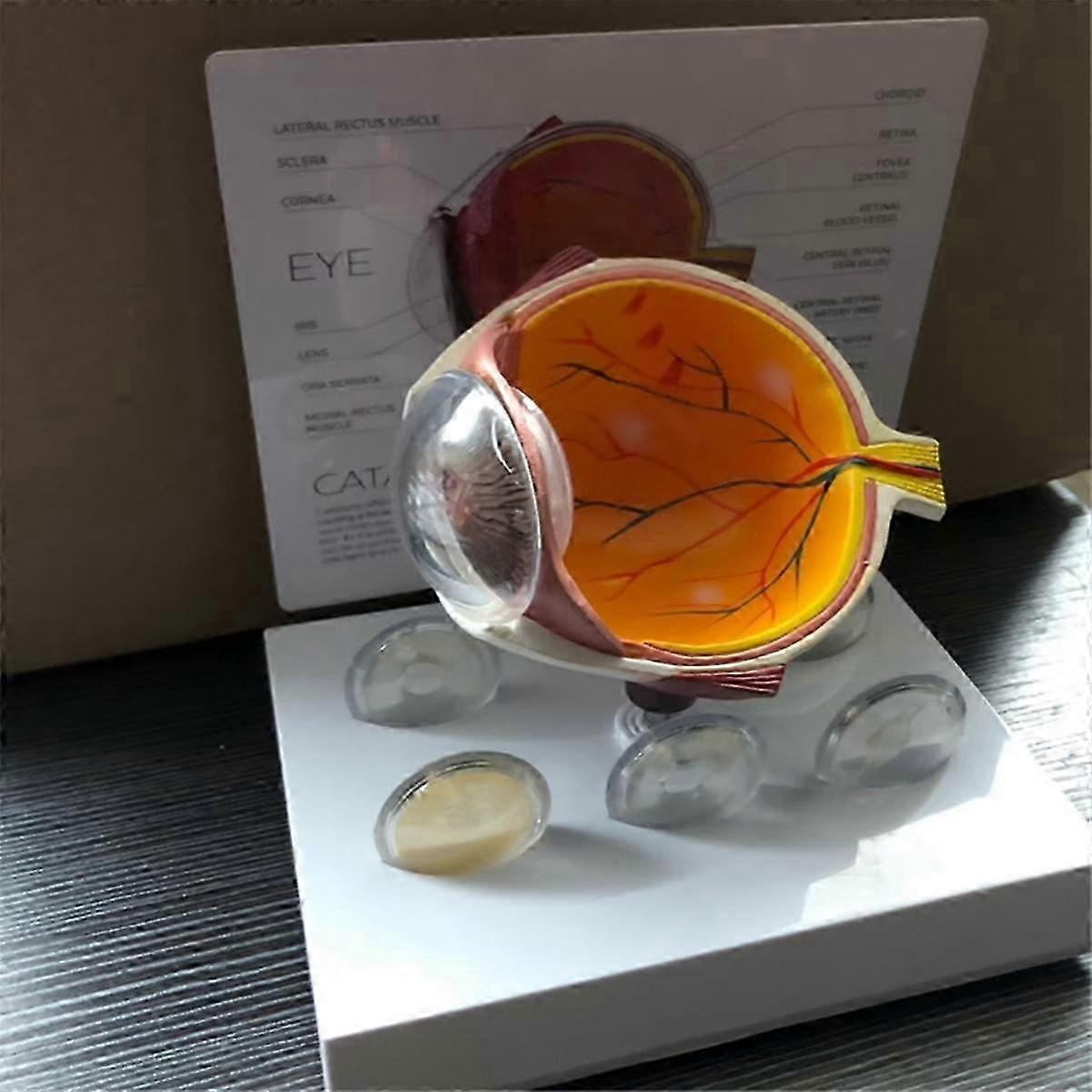 Eyeball Model Human Eye Demonstration Glaucoma Cataract Anatomy Medical ...