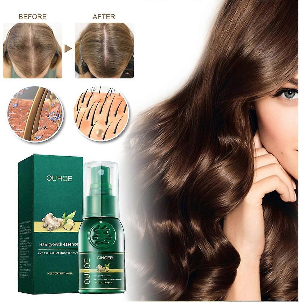 1-3pcs Hair Ginger Growth Products Ginger Fast Grow Oil Anti Hair Loss ...