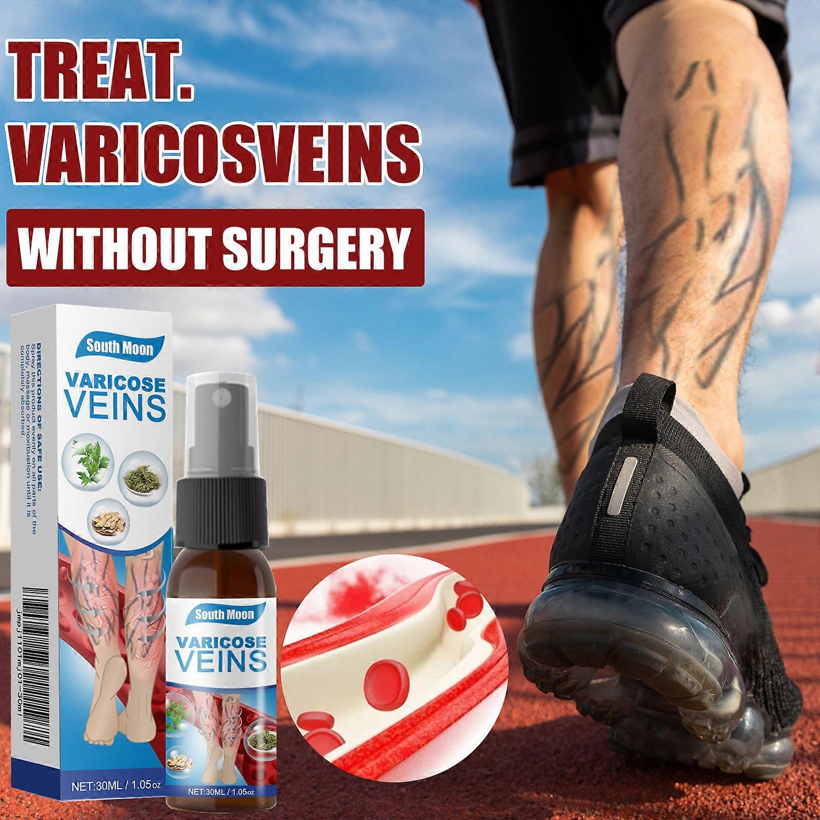 Varicose Vein Massage Spray for South Moon - Say Goodbye to Leg ...