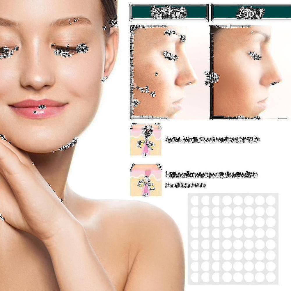 Skin Tag Remover Patches And Improved Formulation Skin Tag Remover ...