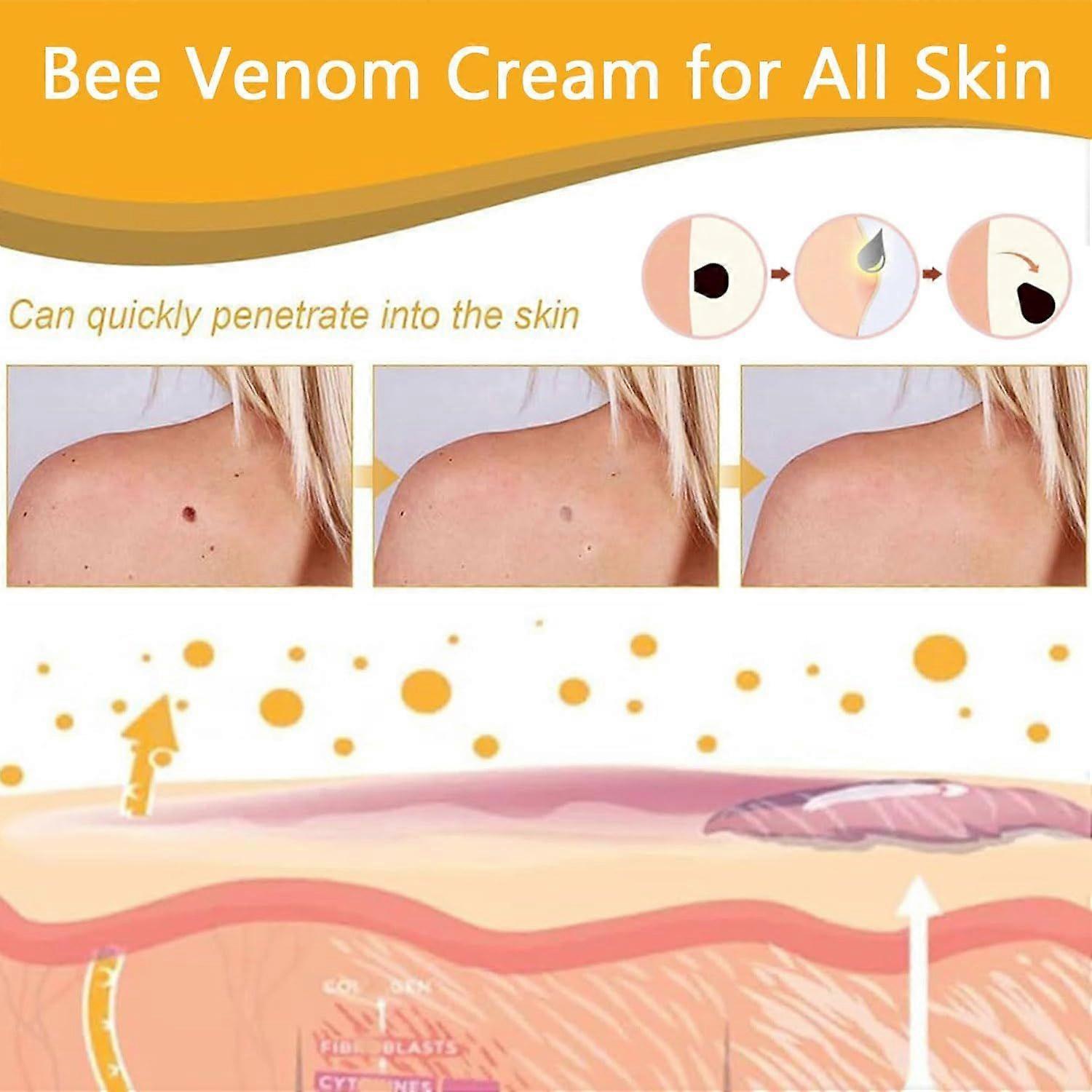 3PCS Bee Venom Repair Cream, Bee Venom Comprehensive Cream, Bee Venom ...
