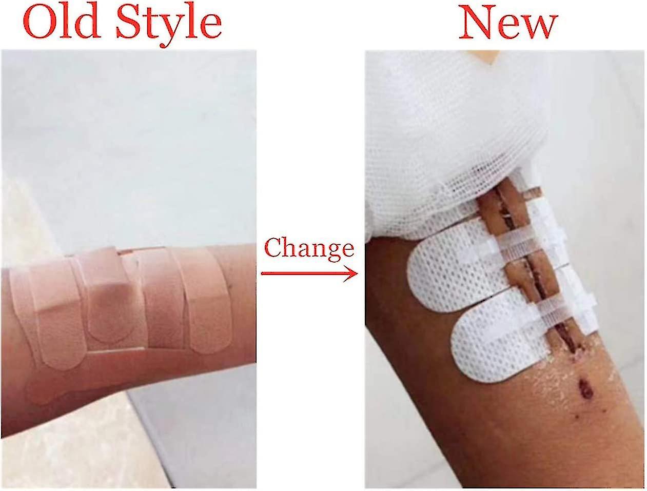 Emergency Wound Closures Band-aid Adhesive Bandages, Zip Stitch ...