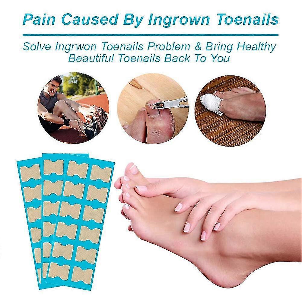 Toe , Ingrown Toe, Toe Patch, Corrector Pedi Tools, Ingrown Toe Patch ...