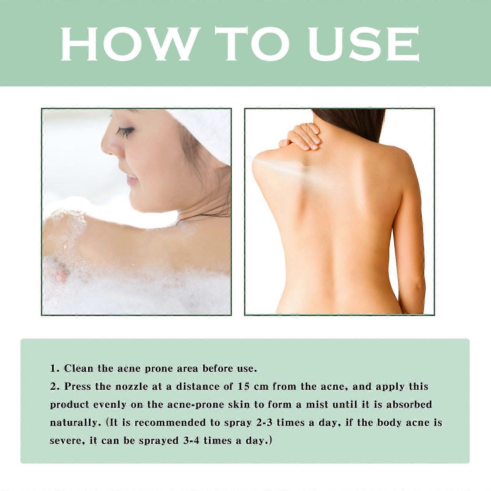 Body Acne Removal Cleanser Spray, Deep Clean Back Arm Fade Acne Beauty ...