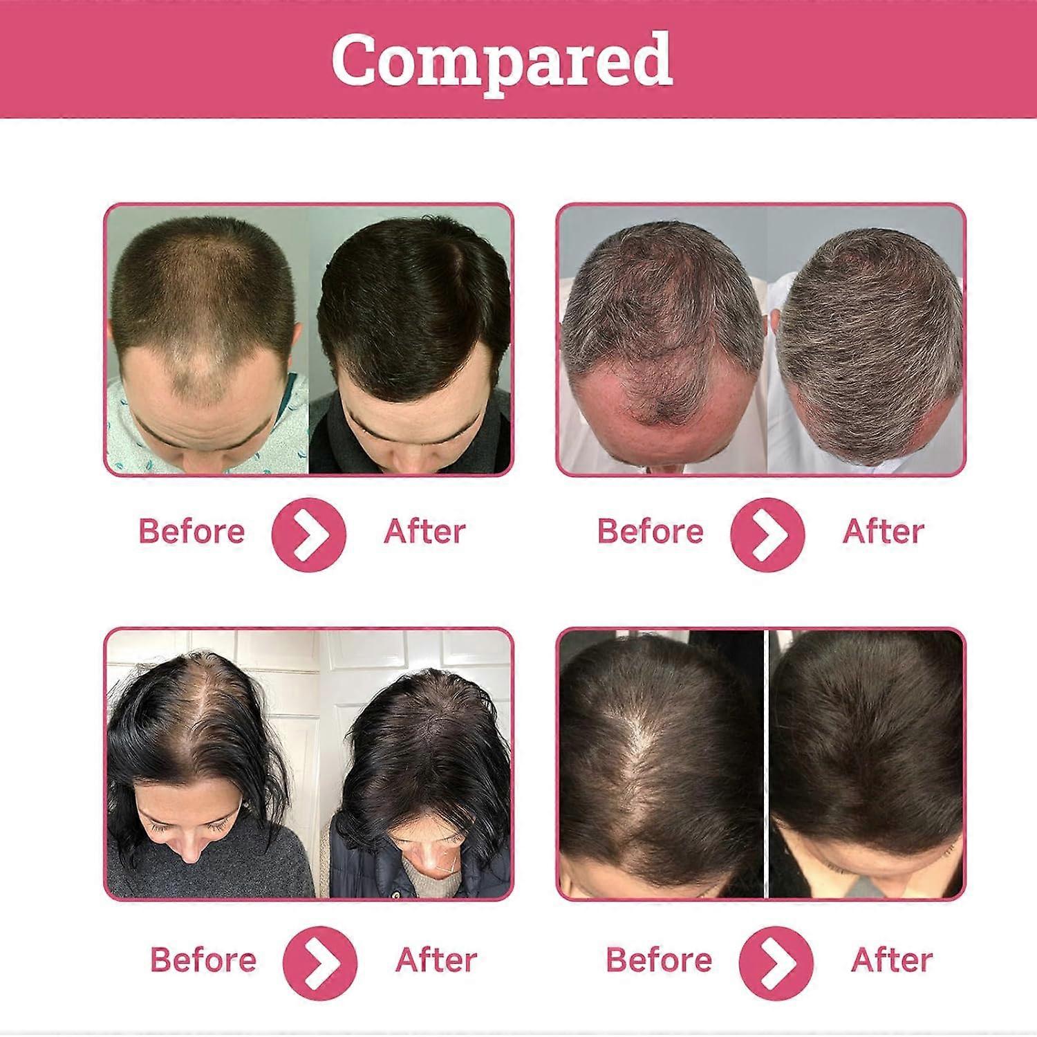 Strawberry Mint Growth Oil, Natural Rosemary Hair Oil, Hair Care and ...