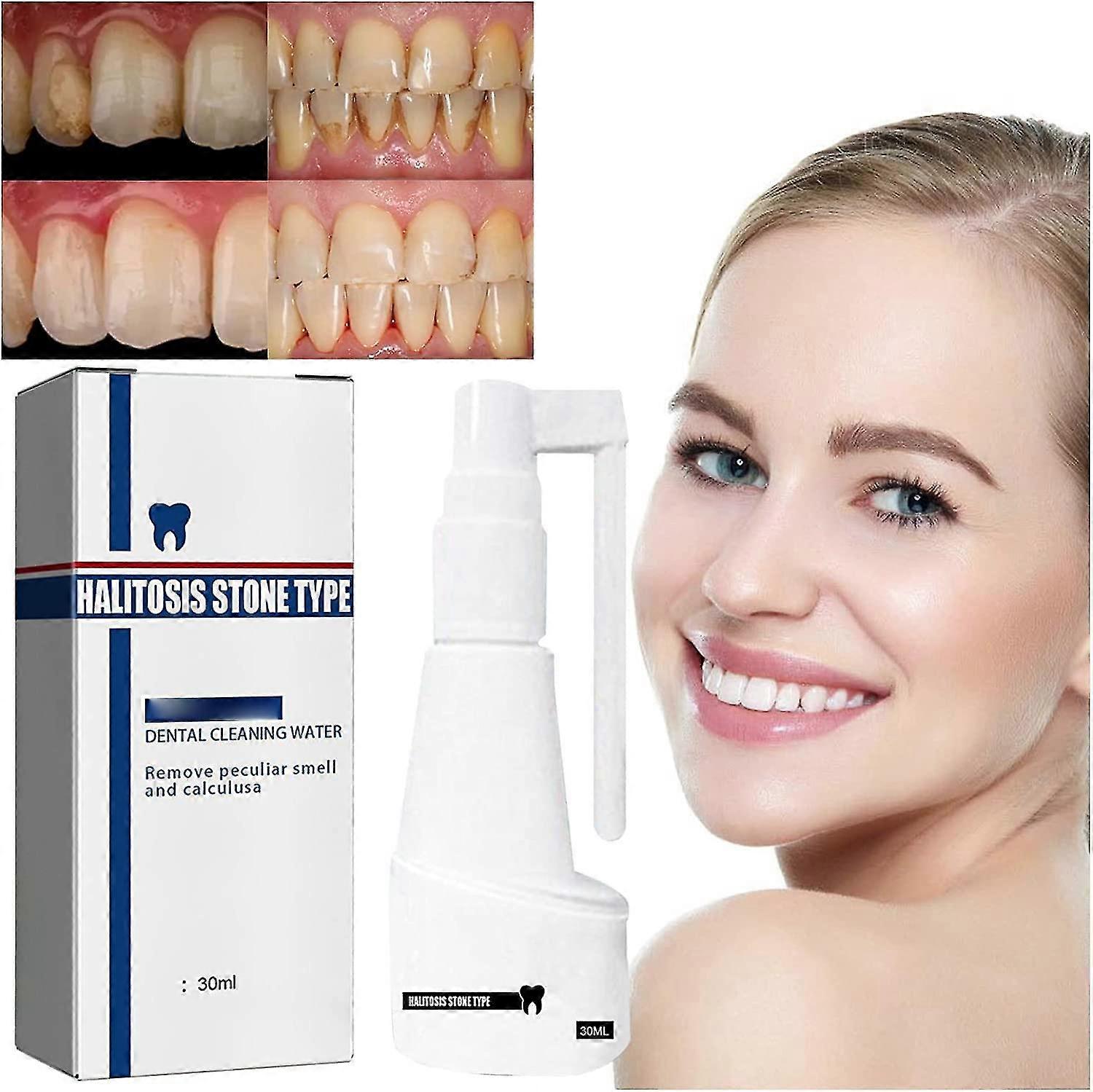 Powerful Stain Removal Toothpaste - Dissolving Spray Tartar Removal ...