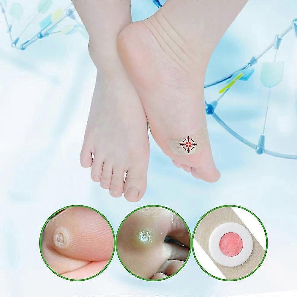 42pcs Foot Plaster Corn Removal Pads Medical Plasters Warts Thorn Patch ...