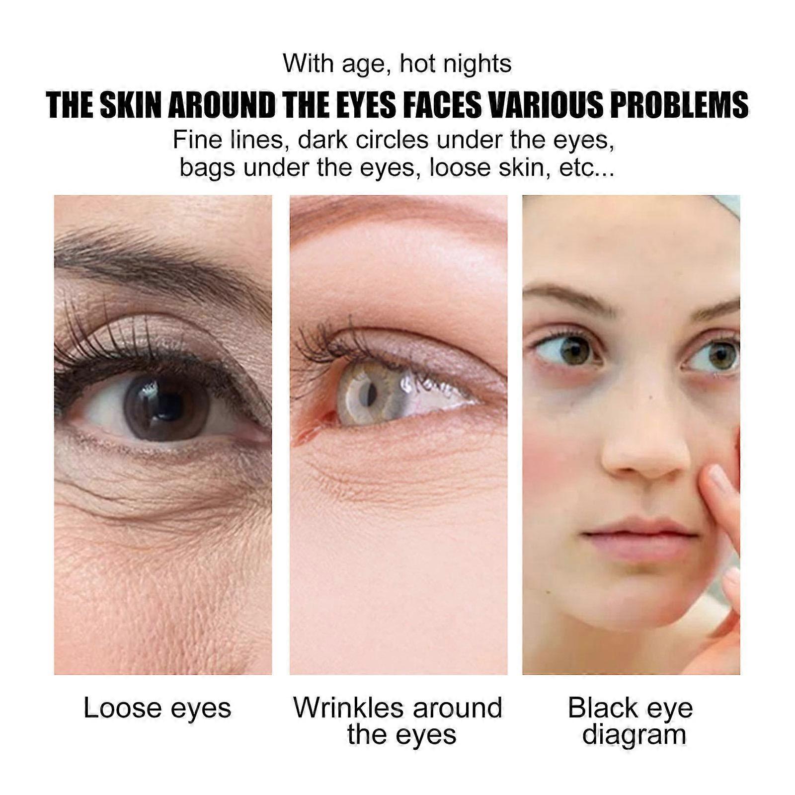 Eye Products Fade Dark Circles And Bags Under Eyes And Fine Lines Eye ...