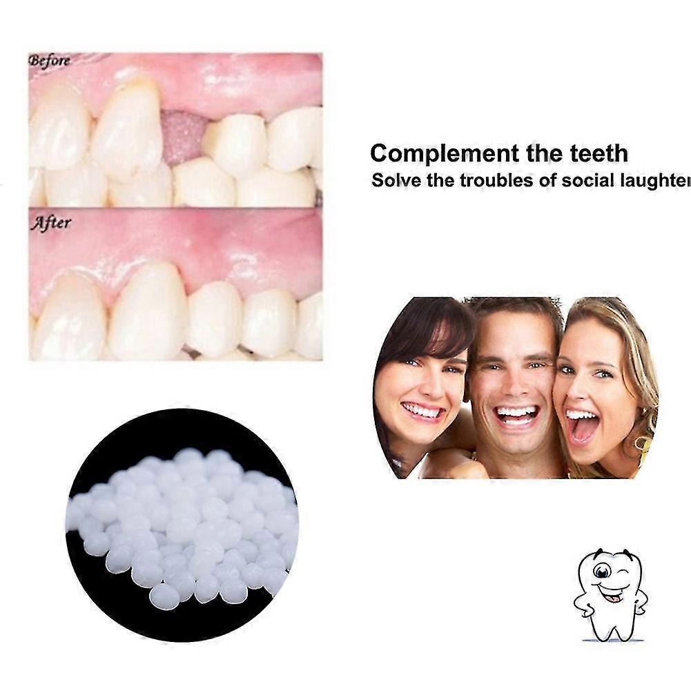 Dental Denture Temporary Restoration Solid Glue Tooth Repair Kit Oral ...